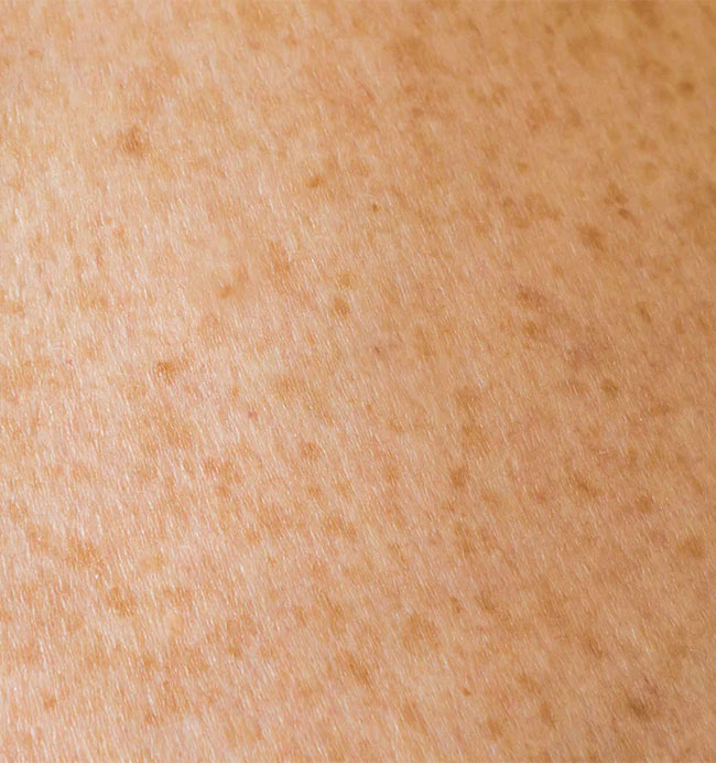 Segle Clinical lo sabe todo sobre el proceso de formación de las ...